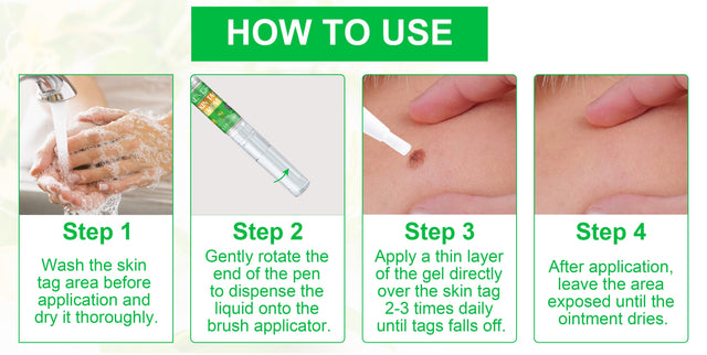 ALIVER Skin Tag Remover (5PCS 3ml/Pen): Your Simple At-Home Solution f