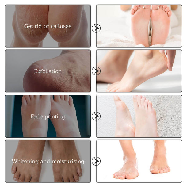 Aliver Natural Exfoliant Foot Peel Mask 3/5 Packs (Lavender) – Aliver ...